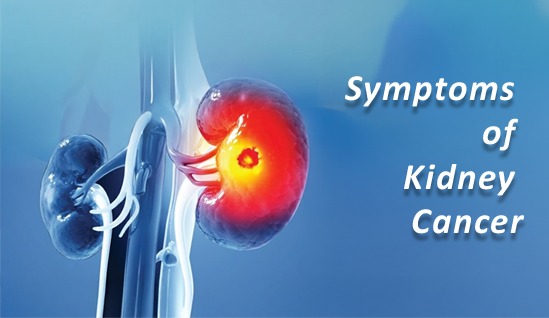 Symptoms of Kidney Cancer and When to See a Doctor - VNH